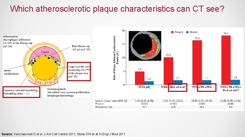 NonInvasive Imaging by CT to Pinpoint Plaques That