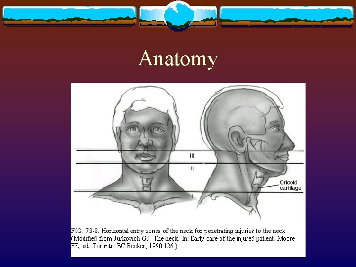 Management of Penetrating Neck Trauma Shashidhar S Reddy