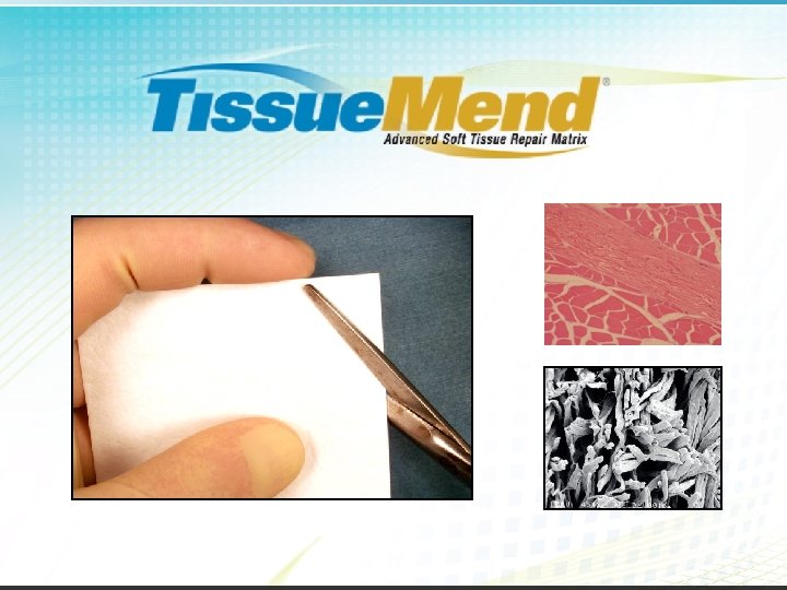 Introduction Product Description Tissue Mend is a strong
