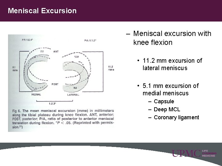 Meniscus Injuries Ian Rice MD How far we