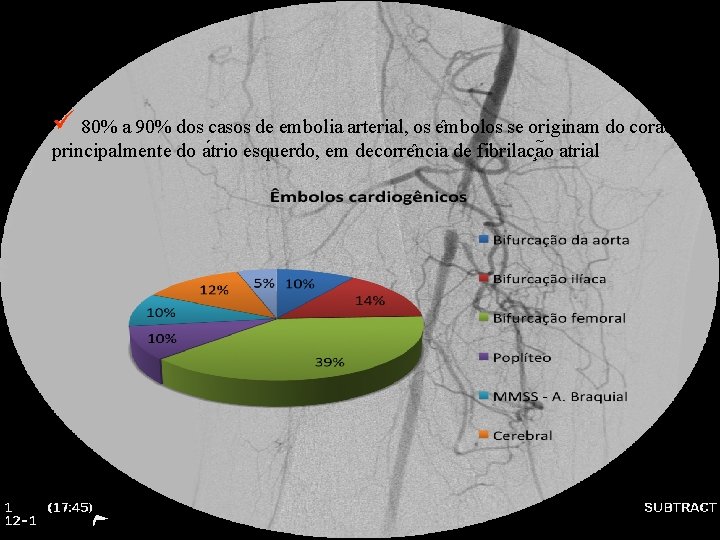 Aula 3 Ocluso Arterial Aguda Prof Sergio Belczak