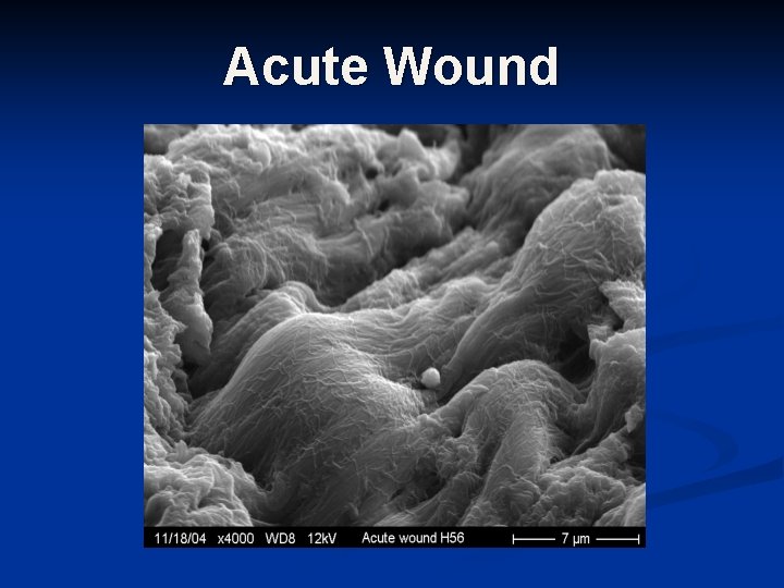 Biofilm Based Wound Care Planktonic vs Biofilm Overview