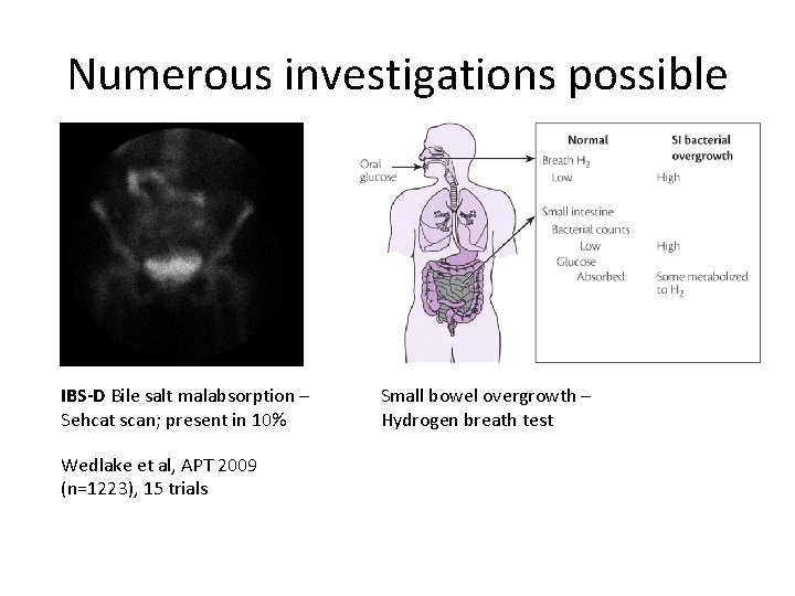 Models of care in IBS Outline Complex aetiology