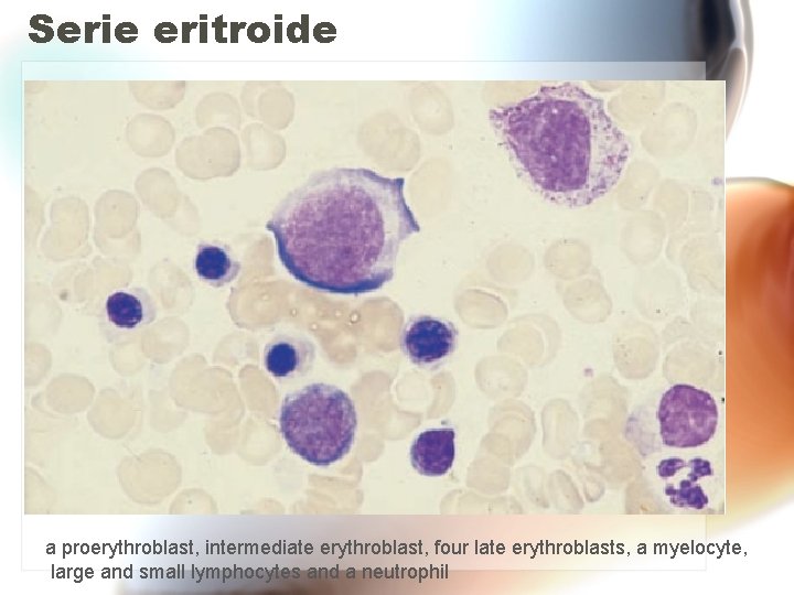 Generalidades del anlisis de aspirado de mdula sea