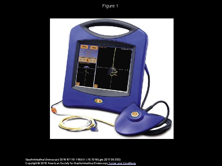 Electromagneticguided placement of nasoduodenal feeding tubes versus ...