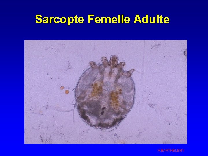 LA GALE ou SCABIOSE Joigny mai 2012 DEFINITION