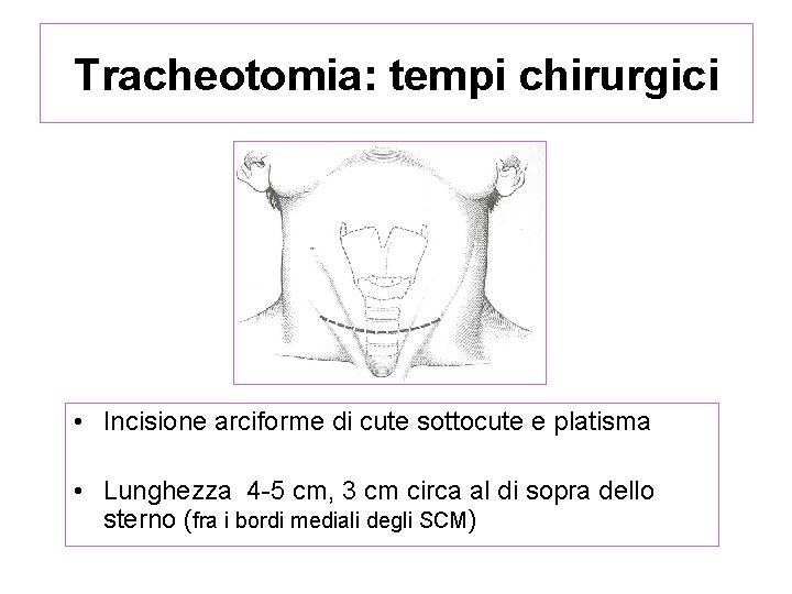 Anatomia della laringe Anatomia della laringe Visione laringoscopica