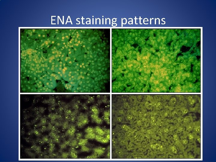 RHEUM UPDATE 2016 II Laboratory Update Mark A