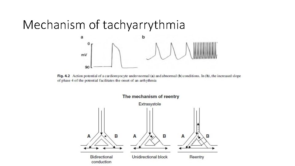CARDIAC RHYTHM ABNORMALITIES Dr T A DIALLO Cardiologist