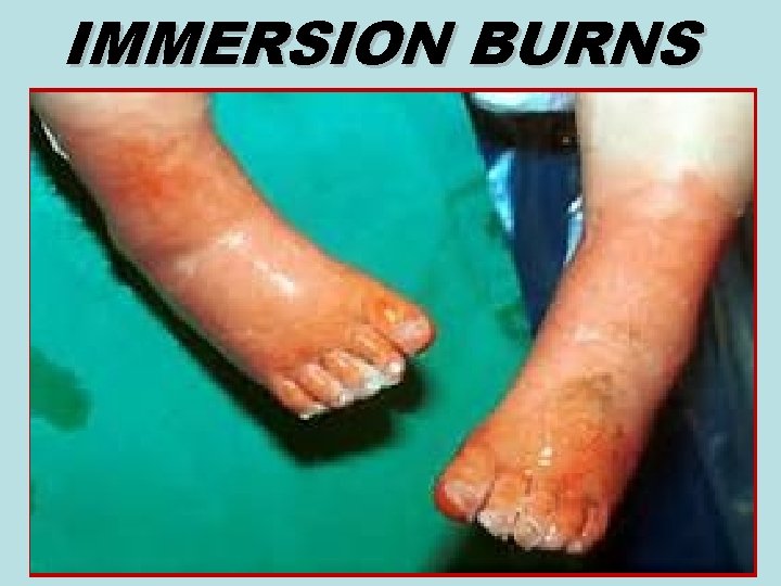 COURSE TITLE Intermediate Child Abuse TCOLE Course 2105