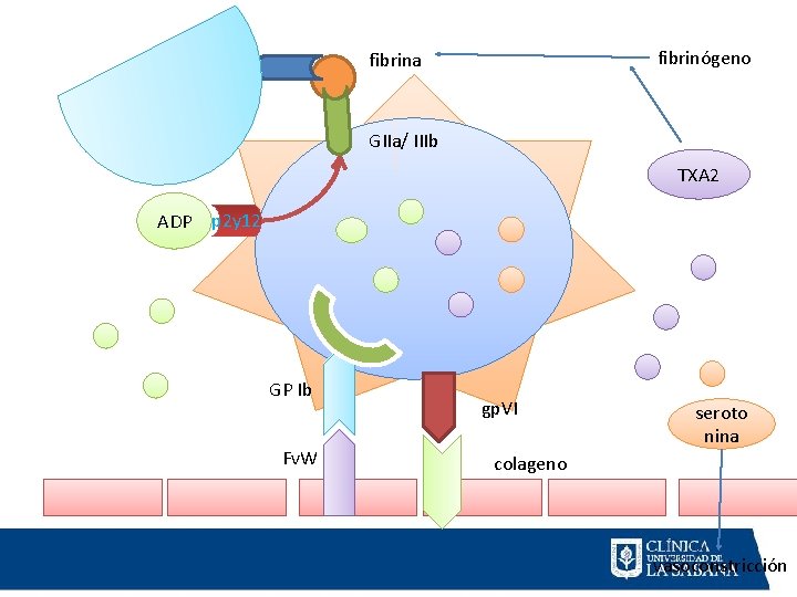 SINDROME CORONARIO AGUDO IAM CON ELEVACION ST WILSON