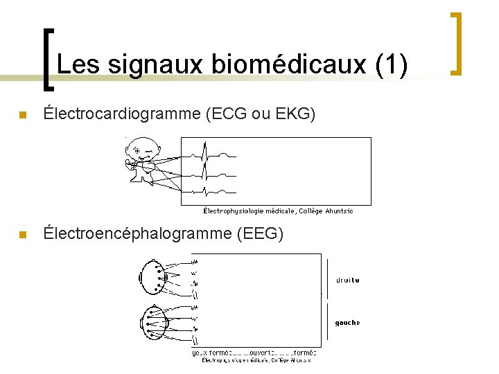 Analyse temporelle et frquentielle des signaux biomdicaux TP