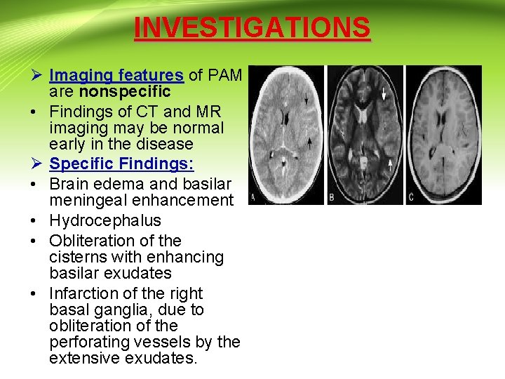 NAEGLERIA FOWLERI BRAIN EATING AMOEBA AMOEBIC MENINGOENCEPHALITIS DR