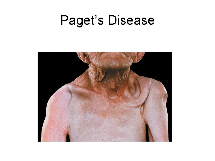 The Skeletal System Three Types of Skeletons 1