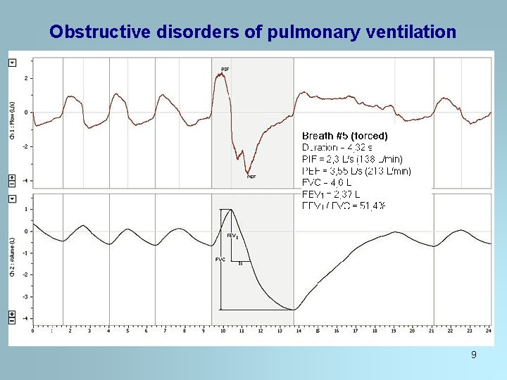 DISORDERS AND EXAMINATION OF PULMONARY VENTILATION Department of