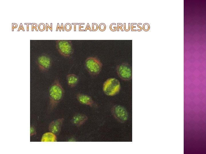 Inmunologa Clnica Laboratorio Si las molculas de anticuerpo