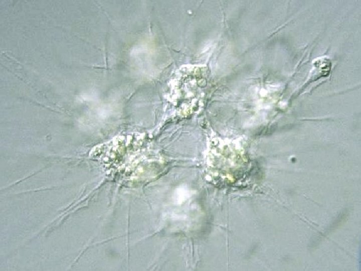 CHAPTER 11 PROTOZOANS Protozoa are a diverse assemblage