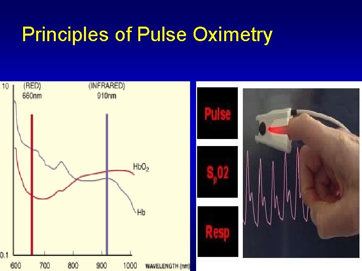 Noninvasive Monitoring in The Intensive Care Unit Iskander