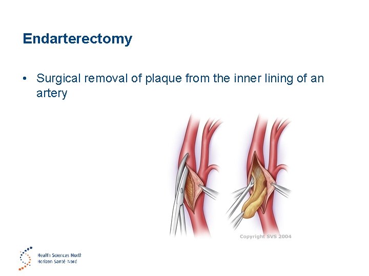 The Cardiovascular System How your Heart and Blood