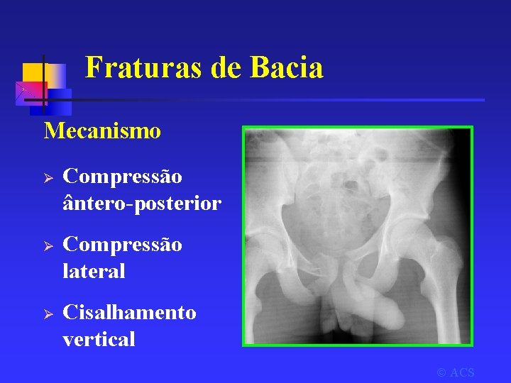 O Comit de Trauma Apresenta Trauma Abdominal ACS