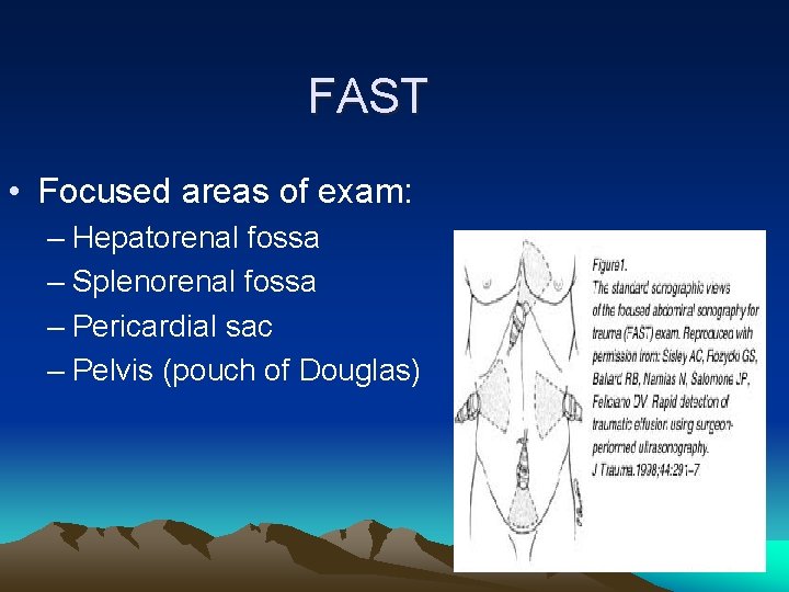 Abdominal injury and Management Dr Mohammadzadeh 13 Feb