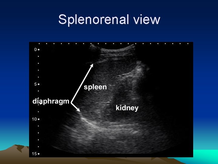 Abdominal injury and Management Dr Mohammadzadeh 13 Feb
