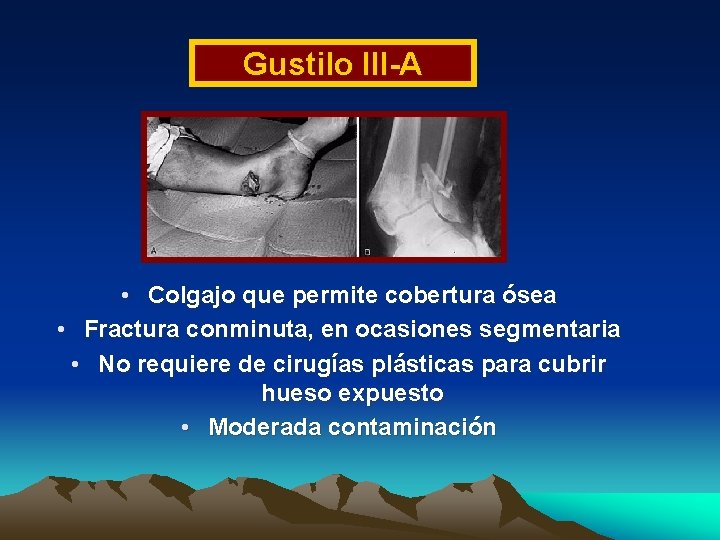 Abordaje de Fracturas Abiertas El grmen no es