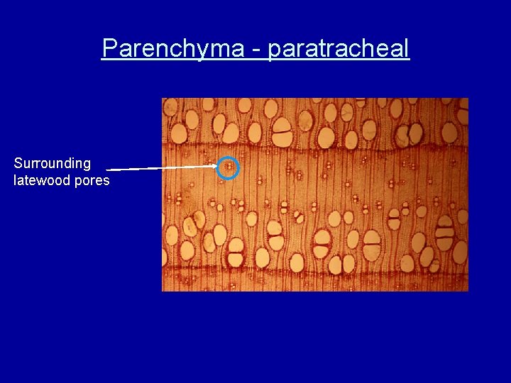 Hardwood anatomy Hardwoods vessel element and pores Vessel