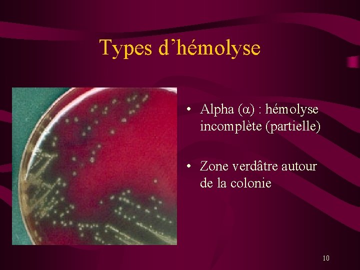 Milieux de culture 1 Milieux de culture Prparation