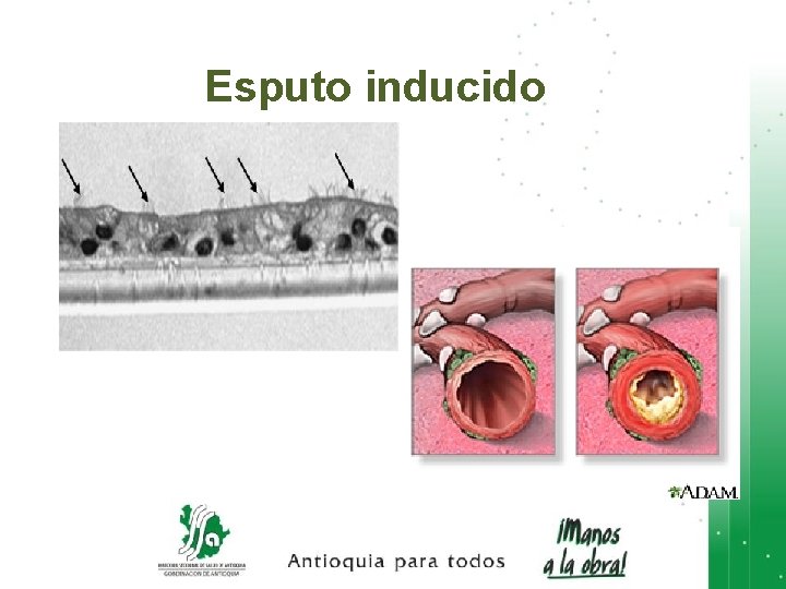 RECOLECCION DE LAS MUESTRAS RESPIRATORIAS PARA LA VIGILANCIA