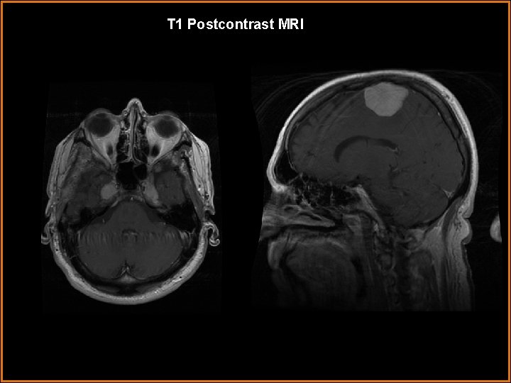 Radiological Category Neuroradiology Principal Modality 1 MRI Principal