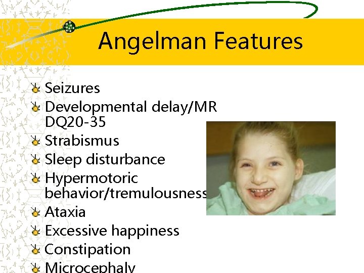 Angelman Syndrome Craig Dobson MD CPT MC USAR