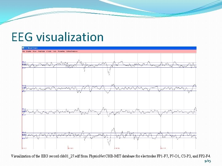 Feature extraction from electroencephalographic records using EEGFrame framework
