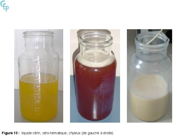 ITEM 202 EX ITEM 312 EPANCHEMENT PLEURAL Tableau
