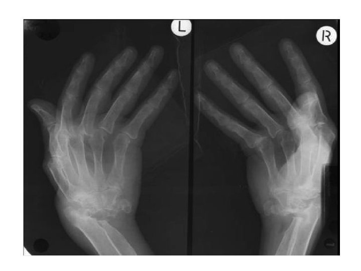 From Approach to Articular and Musculoskeletal Disorders Harrisons