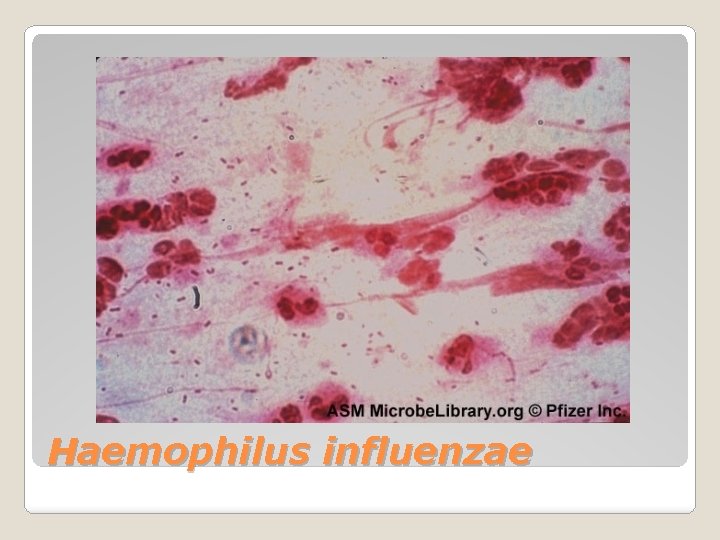 Haemophilus spp Microbiologa I M Paz 2012 Haemophilus