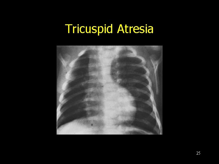 Congenital Heart Disease Initial evaluation and stabilization Priscilla