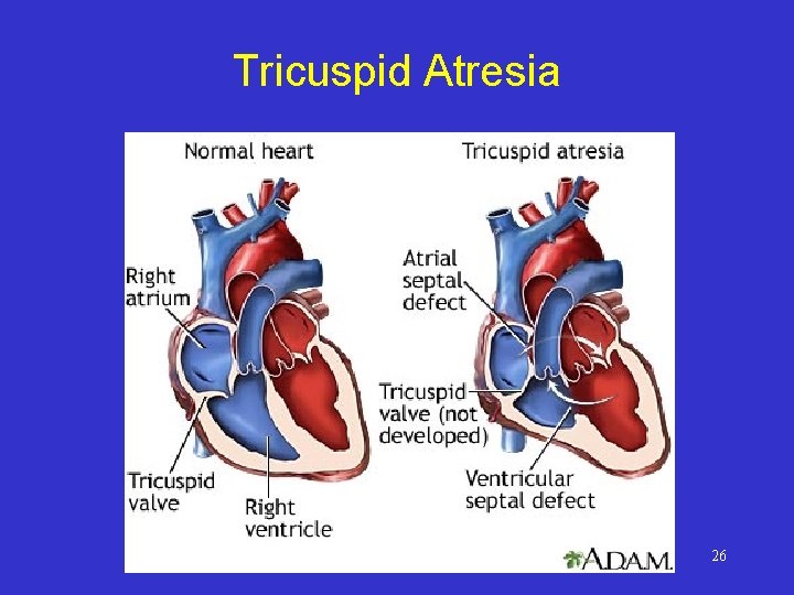 Congenital Heart Disease Initial evaluation and stabilization Priscilla
