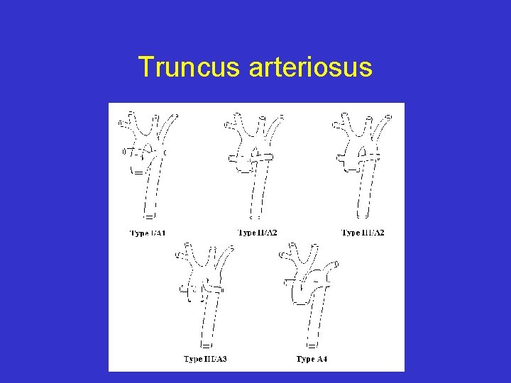 Congenital Heart Disease Initial evaluation and stabilization Priscilla