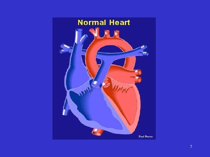 Congenital Heart Disease Initial evaluation and stabilization Priscilla