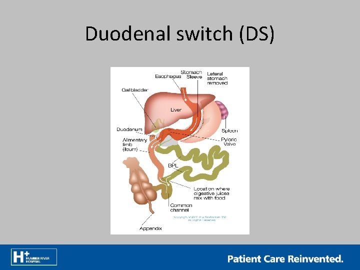 Medical Surgical Options for the Bariatric Patient Michelle