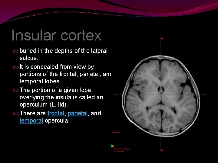 Anatomy of Brain Dr Rima Pathak Gross Anatomy