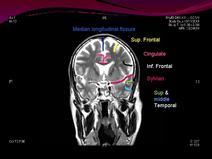 Anatomy of Brain Dr Rima Pathak Gross Anatomy