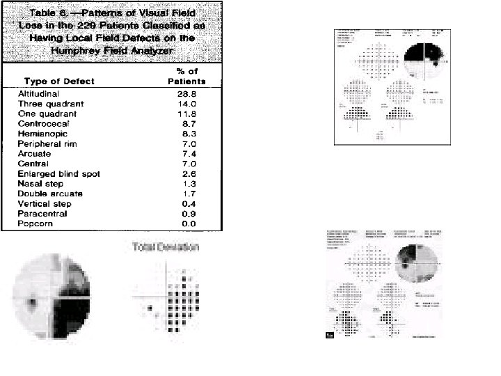 The Optic Neuritis Treatment Trial ONTT R R