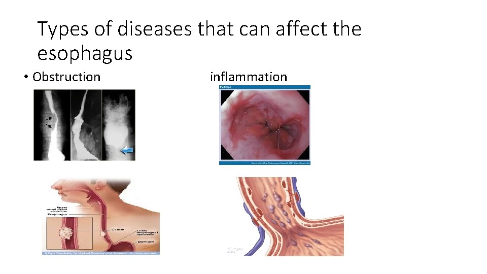 Gastrointestinal pathology esophagus and stomach lecture 1 Dr