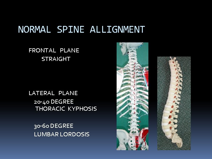 SPINAL DEFORMITIES NORMAL SPINE ALLIGNMENT FRONTAL PLANE STRAIGHT