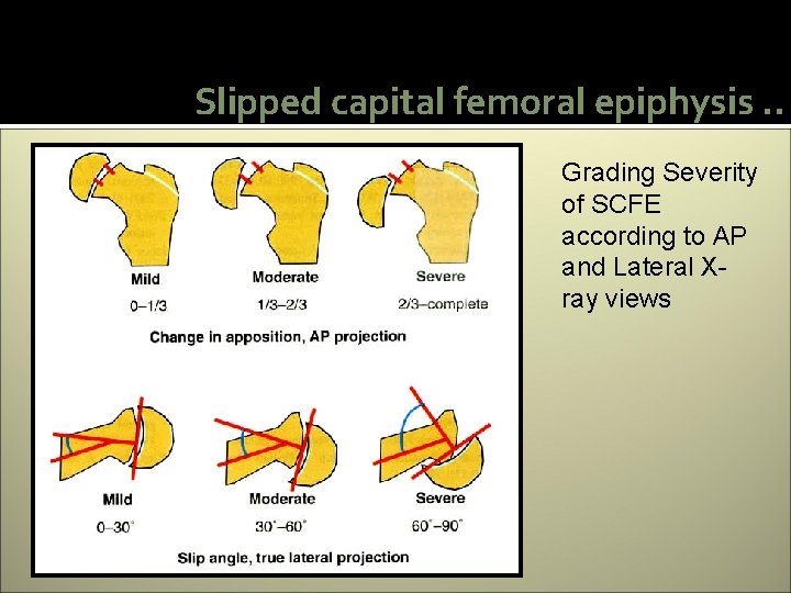 HIP DISORDERS Medical ppt By Bashar Alhttp hastaneciyiz