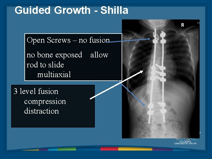 Classification of Growth Friendly Spine Implants David L