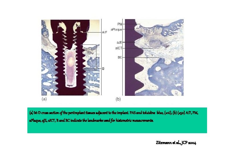 How to treat ailing and failing implants Roland