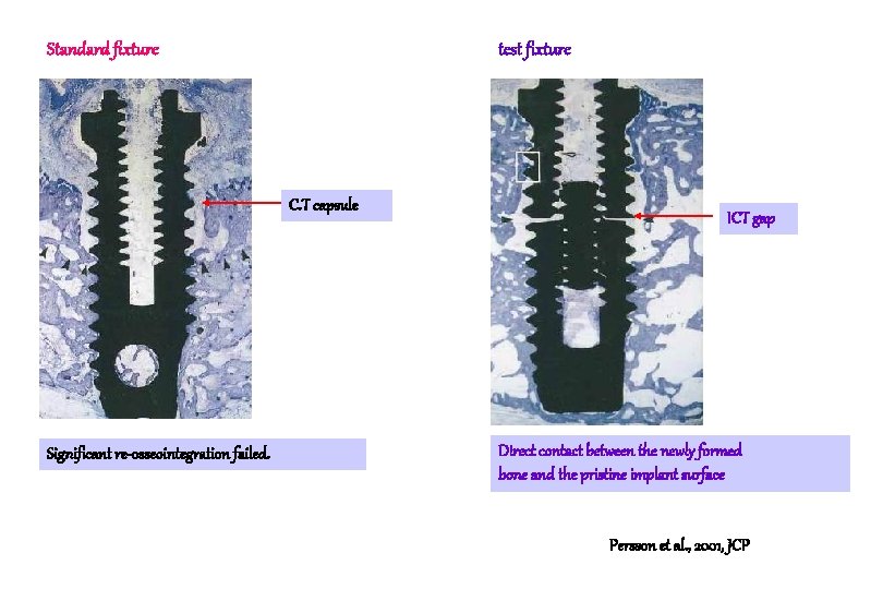 How to treat ailing and failing implants Roland
